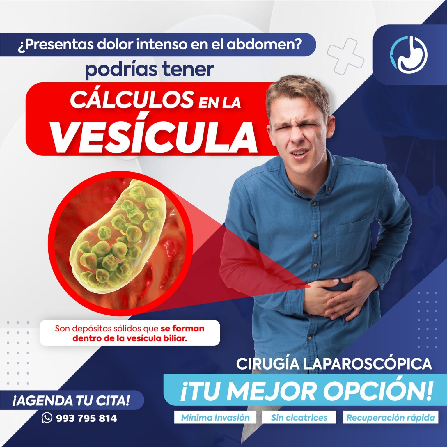 Cálculos en la Vesícula Biliar: Causas, Síntomas y Tratamiento – Doctor ...